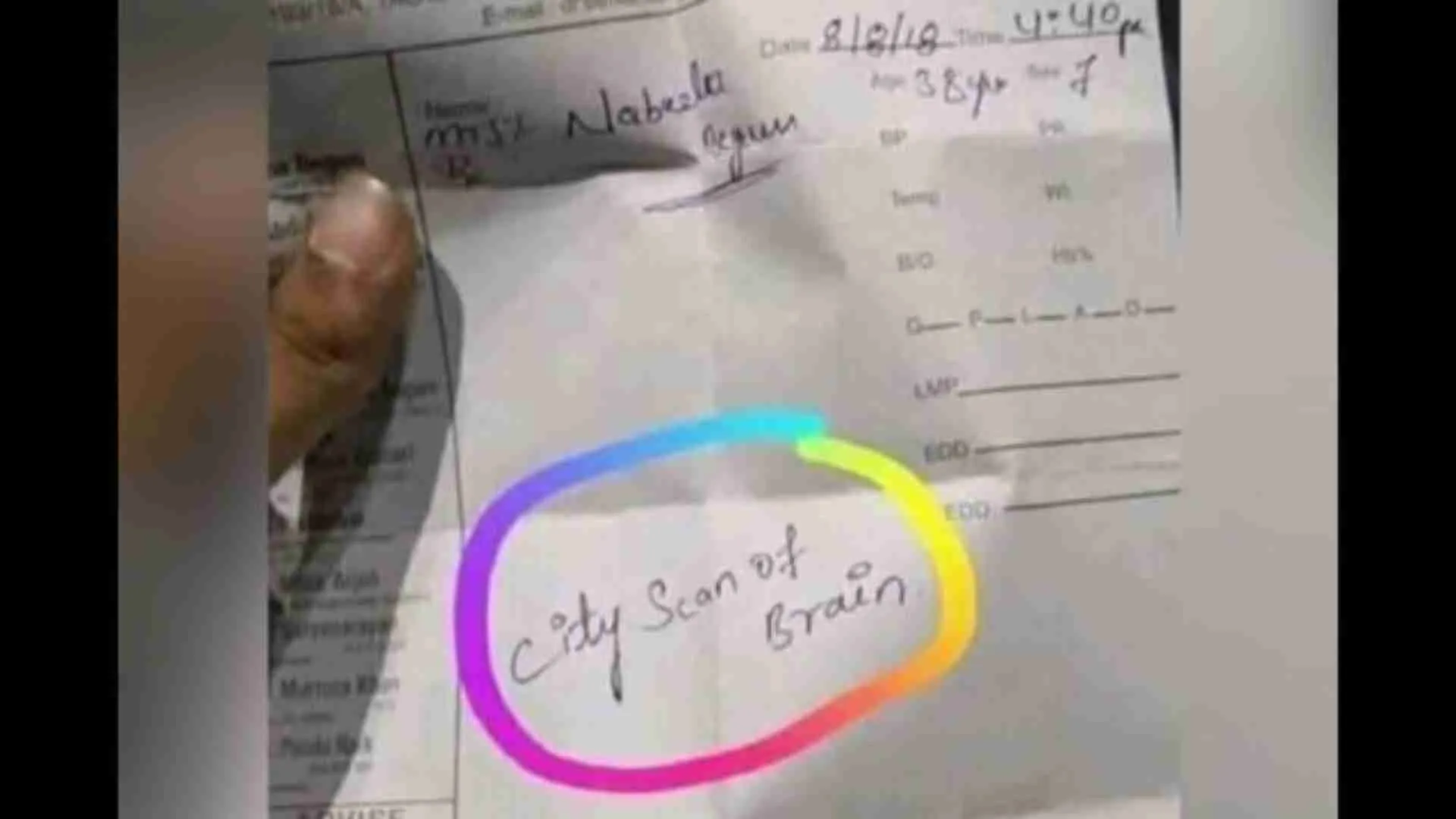 Doctor's Prescription Error: ‘City Scan’ For Brain, Internets Calls Him ...